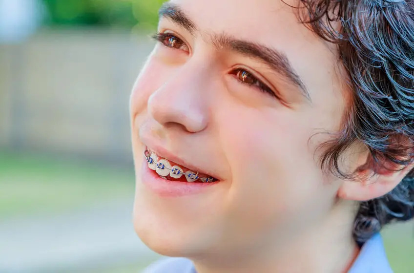 Orthodontics: It’s Not Just About Straightening Teeth – New York Family